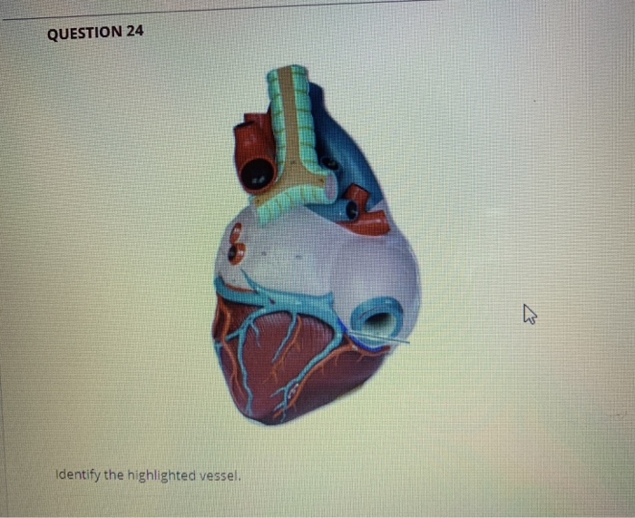 Solved Identify the highlighted vessel. Identify the | Chegg.com Solved Identify the highlighted vessel. Identify the | Chegg.com
