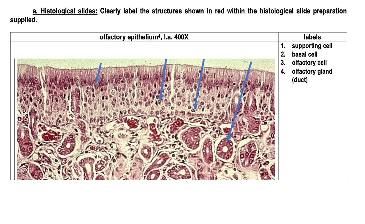 Solved a. Histological slides: Clearly label the structures | Chegg.com