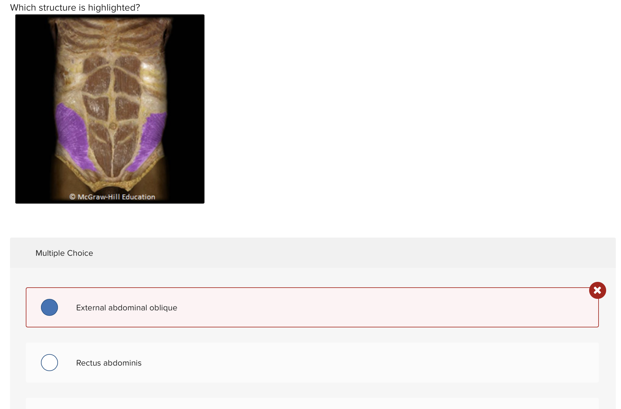 Which structure is highlighted? Multiple Choice | Chegg.com