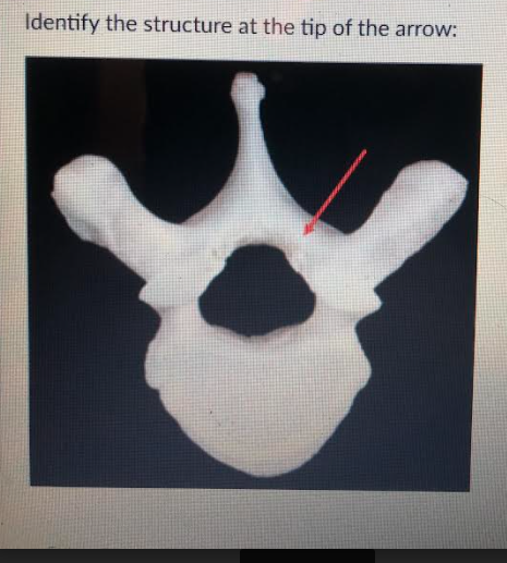 Solved Identify the structure at the tip of the arrow: YA | Chegg.com