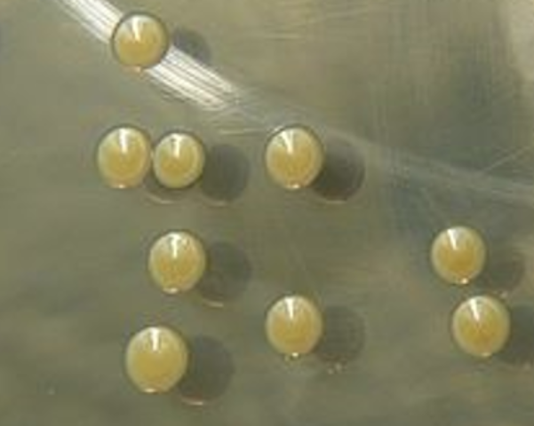 Solved Describe the colony morphology (elevation and whole | Chegg.com