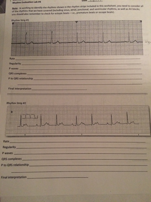 Solved Rhythm Evaluation Lab Note: In working to identify | Chegg.com