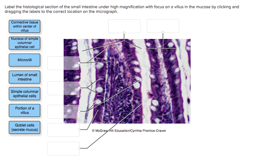 Solved Label the histological section of the small intestine | Chegg.com