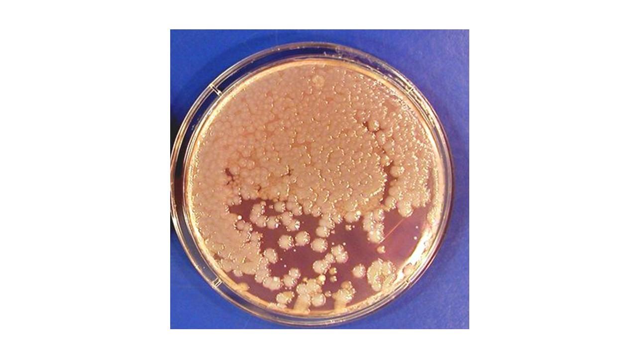 Solved Evaluate this streak plate. A perfect streak A | Chegg.com