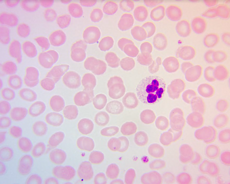 Solved ERYTHROCYTE MORPHOLOGY: PLATELET MORPHOLOGY: PLATELET | Chegg.com