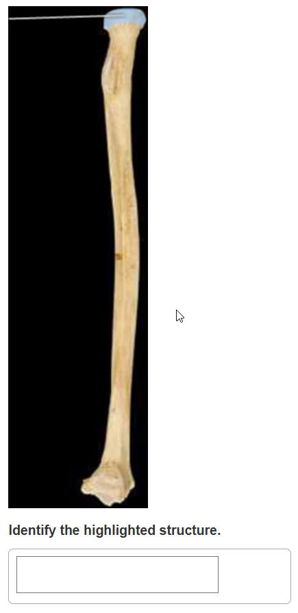 Solved Identify the highlighted structure. Identify A A B | Chegg.com