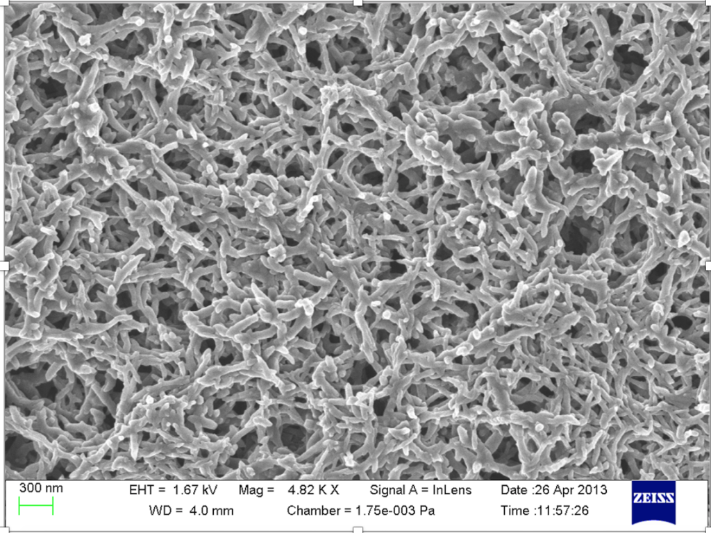 Solved There is a scanning electron microscope image of | Chegg.com