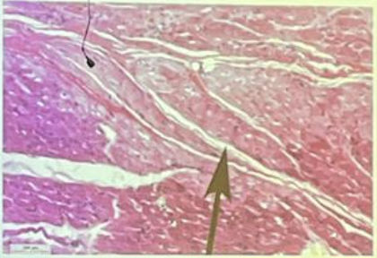Solved PLEASE identify structure shown by arrow ın heart | Chegg.com