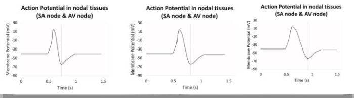 Solved Action Potential in nodal tissues (SA node & AV node) | Chegg.com