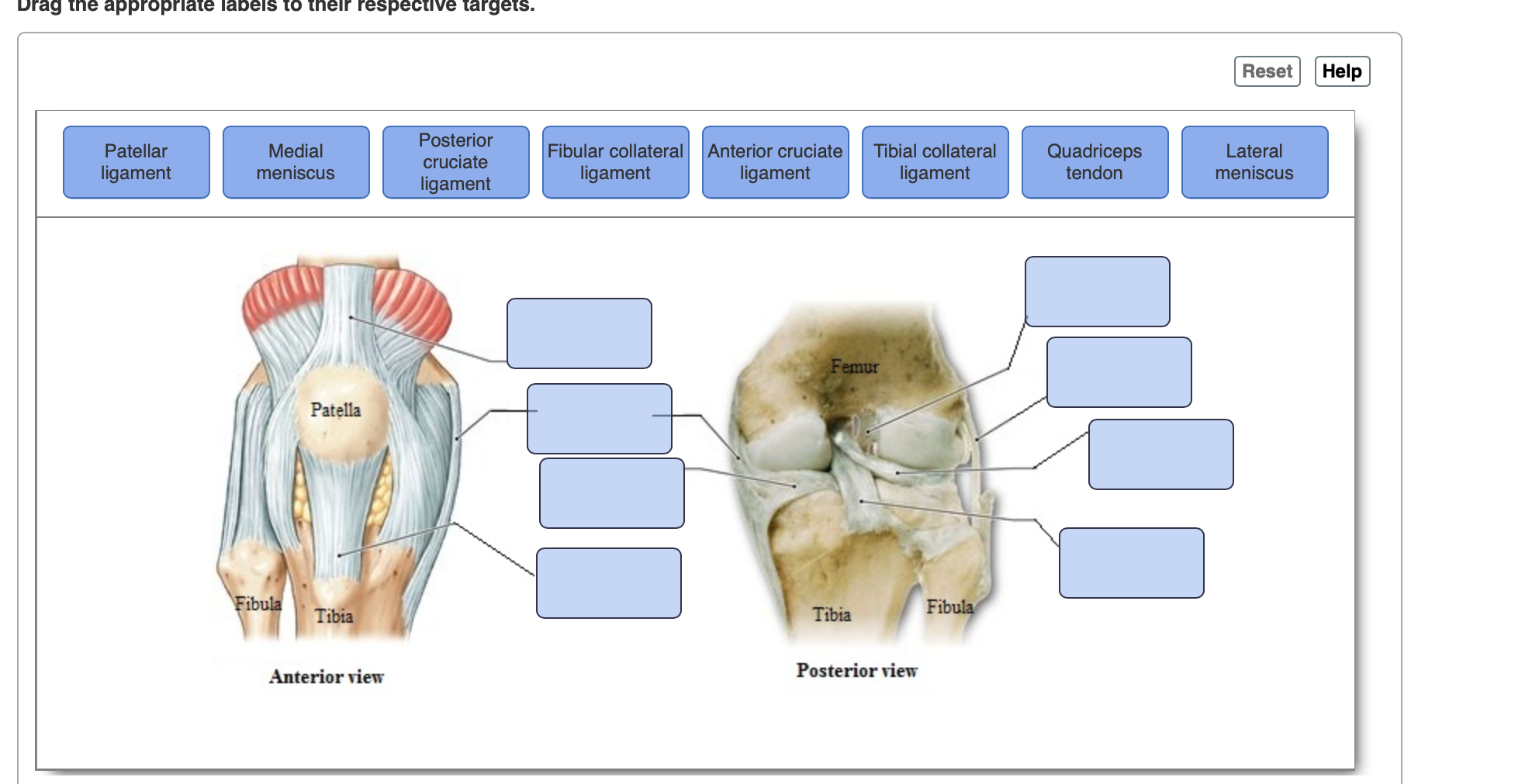 Solved PAL: Cadaver > Appendicular Skeleton: Joints > Quiz > | Chegg.com