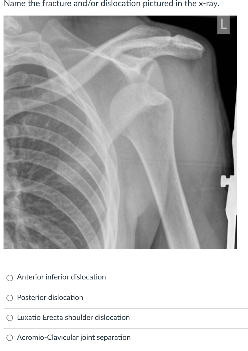 Solved Name the fracture and/or dislocation pictured in the | Chegg.com