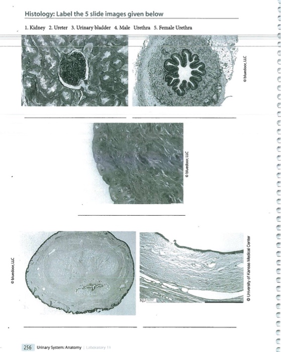 Solved Histology: Label the 5 slide images given below 1. | Chegg.com