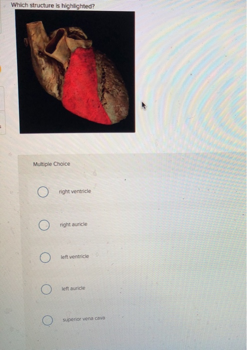 Solved Which structure is highlighted? Multiple Choice right | Chegg.com