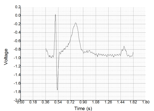Solved Estimate the −3 dB frequencies required for the | Chegg.com