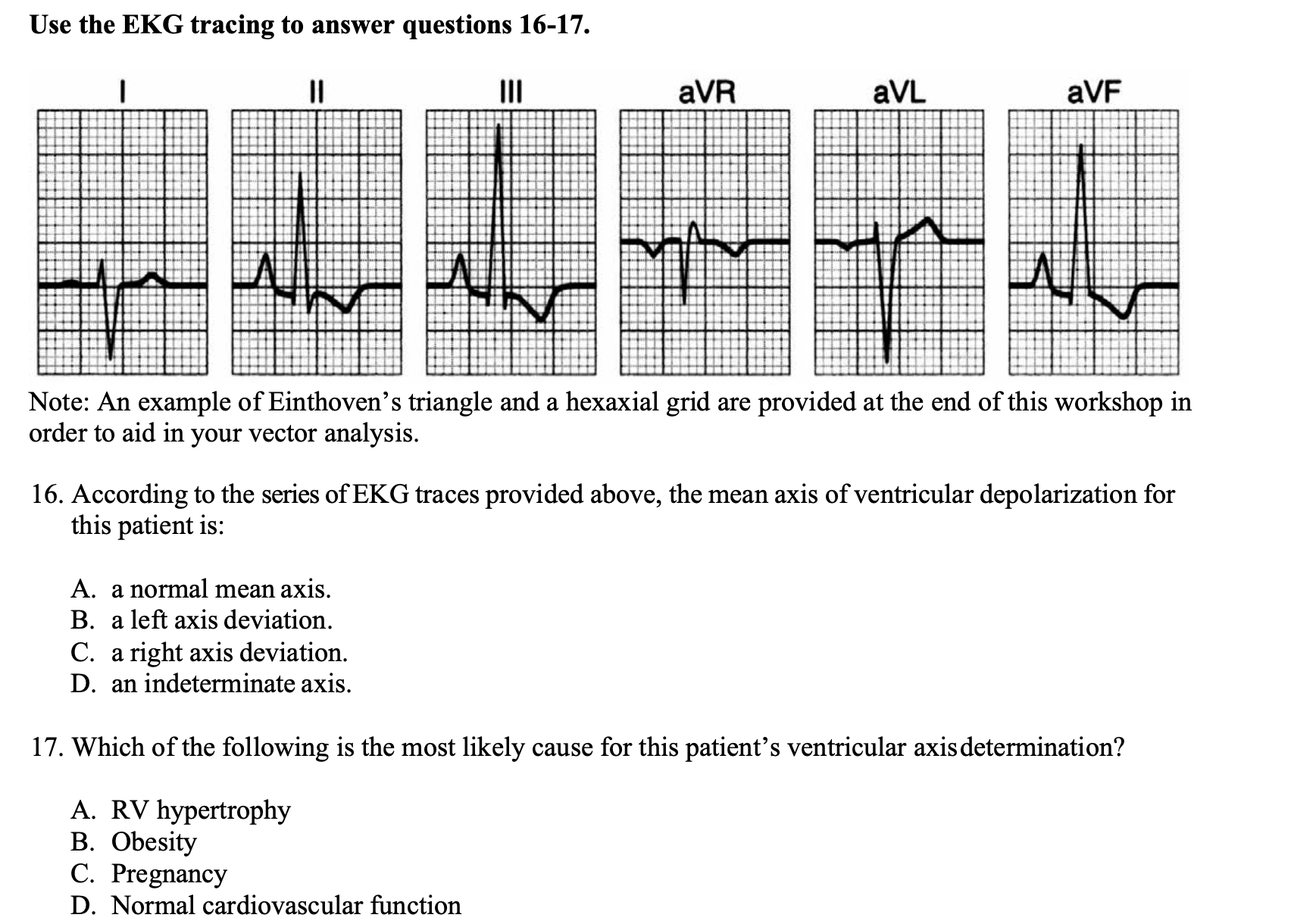 Solved Use the EKG tracing to answer questions 16-17.order | Chegg.com