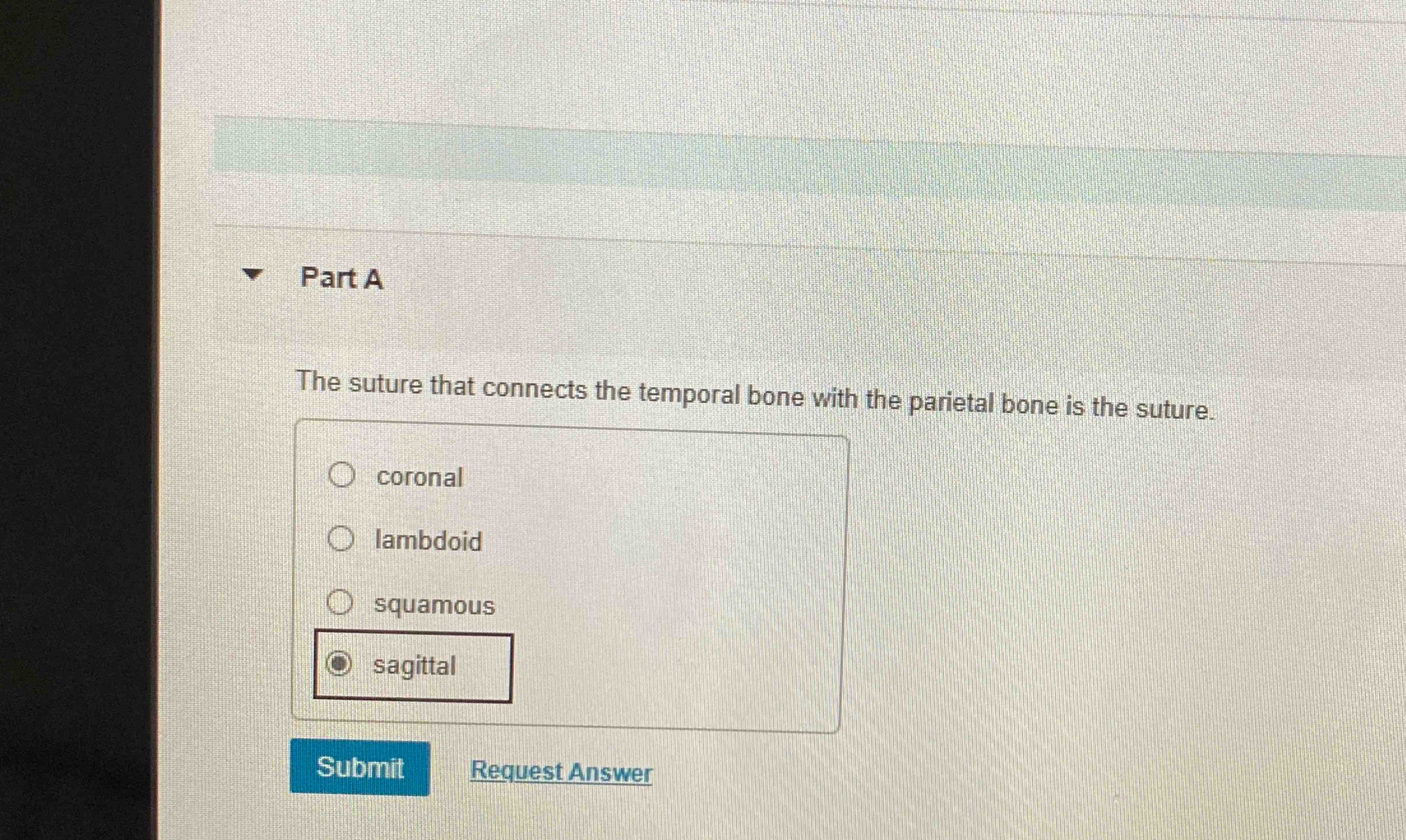 Solved Part AThe suture that connects the temporal bone with | Chegg.com