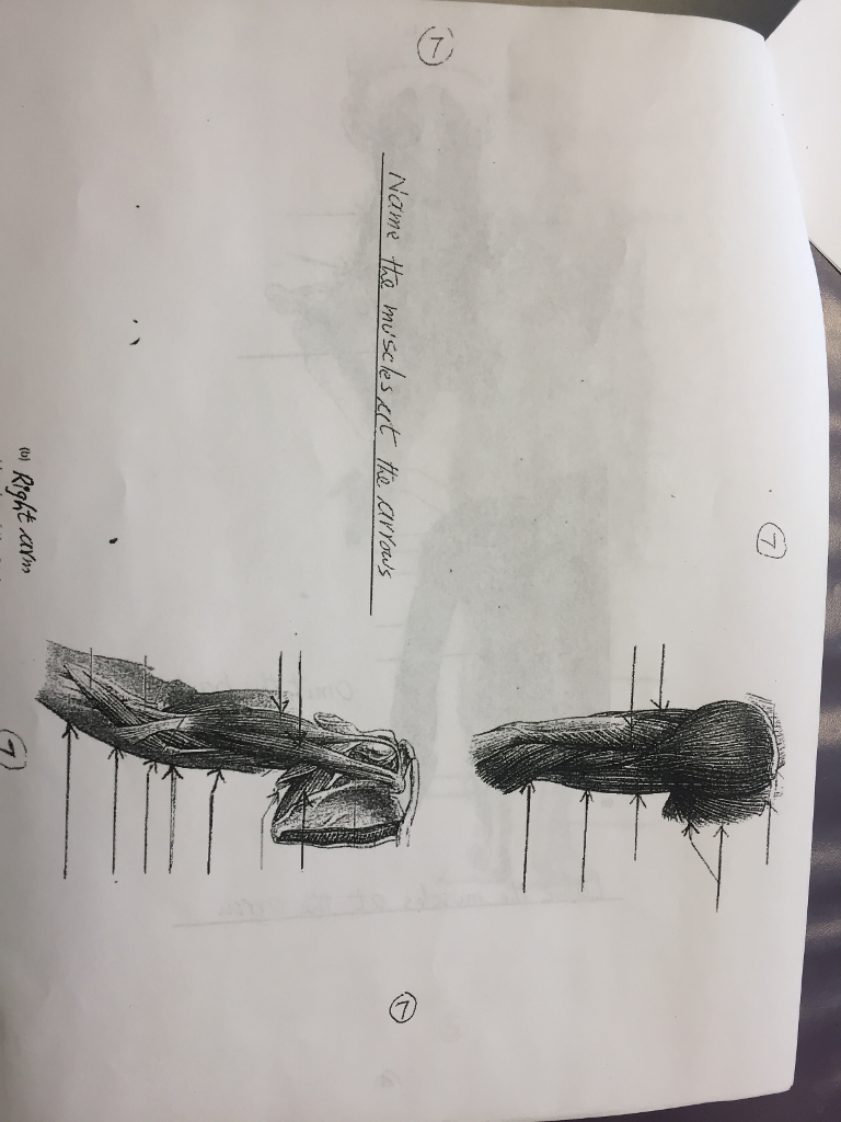 Solved Name the muscles at the arrow Label Right arm | Chegg.com