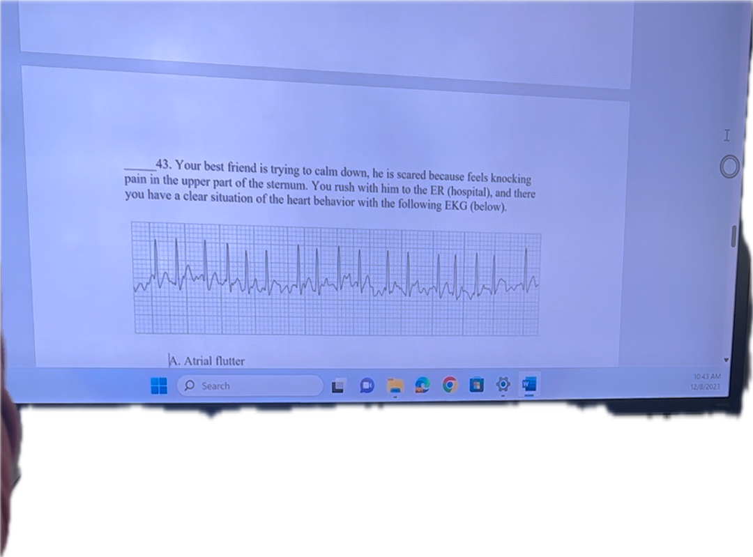 Solved Cardio Review 1. Cardiac cycle runs in systole and | Chegg.com
