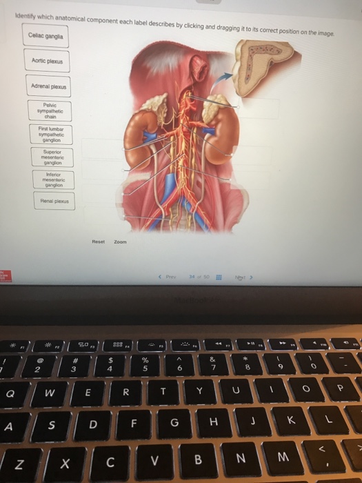 Solved identify which anatomical component each label | Chegg.com