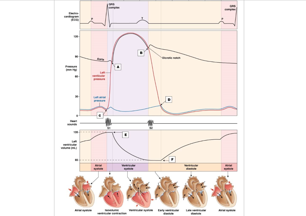 Solved QRS complex QRS complex Electro- cardiogram (ECG) 90- | Chegg.com