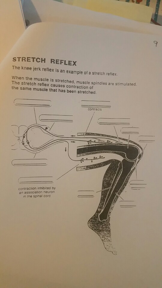 Solved STRETCH REFLEX The knee jerk reflex is an example of | Chegg.com