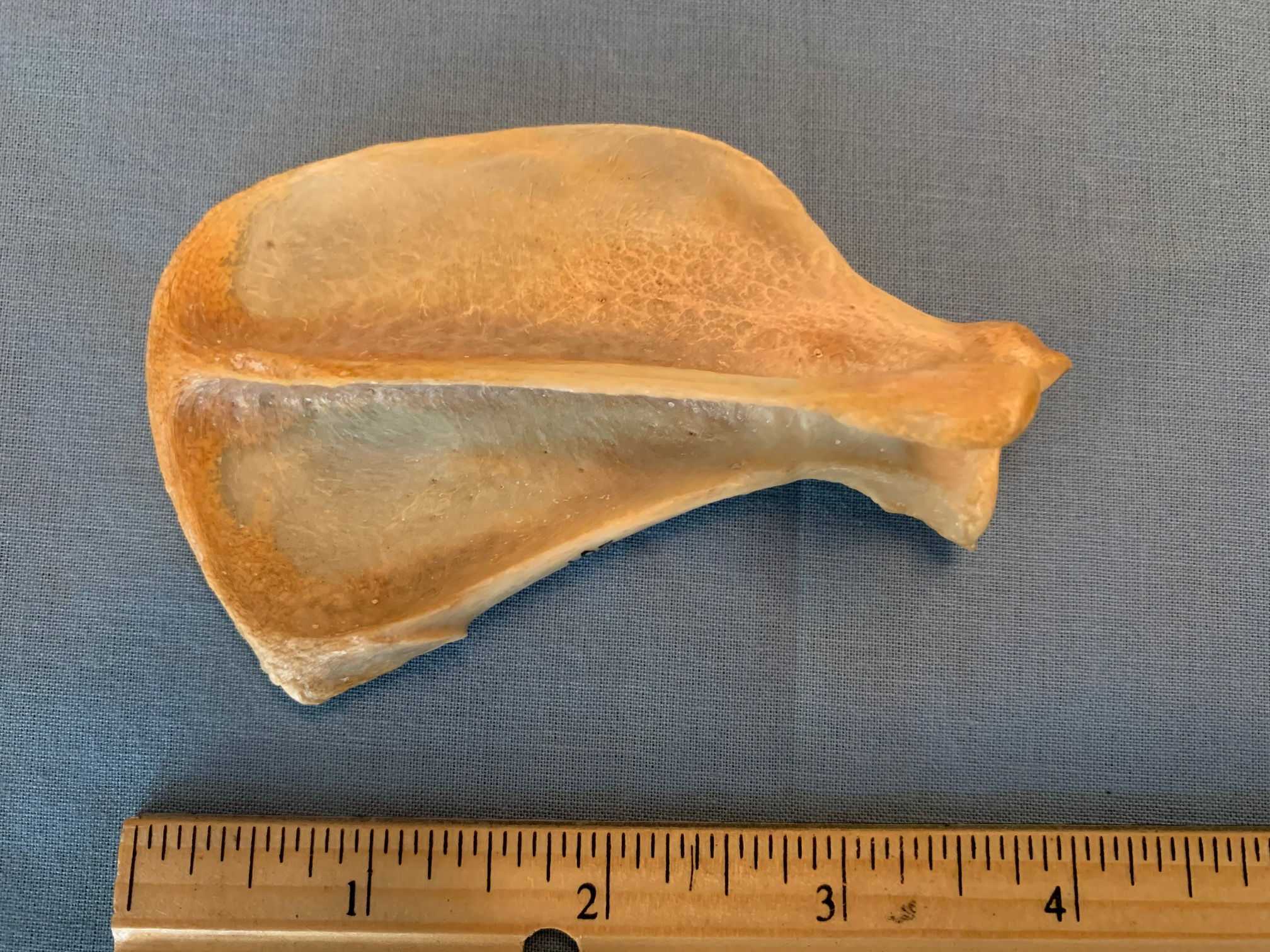 Solved Based on the morphology of this scapula what do you | Chegg.com