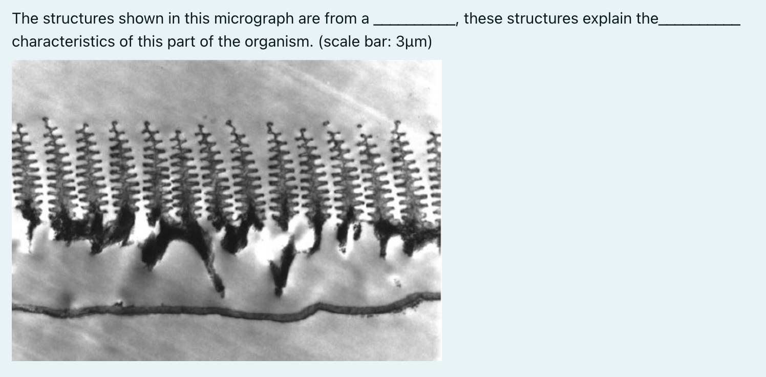 Solved The structures shown in this micrograph are from a | Chegg.com