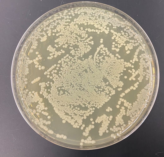 Pour plate and Spread plate: How would you describe | Chegg.com