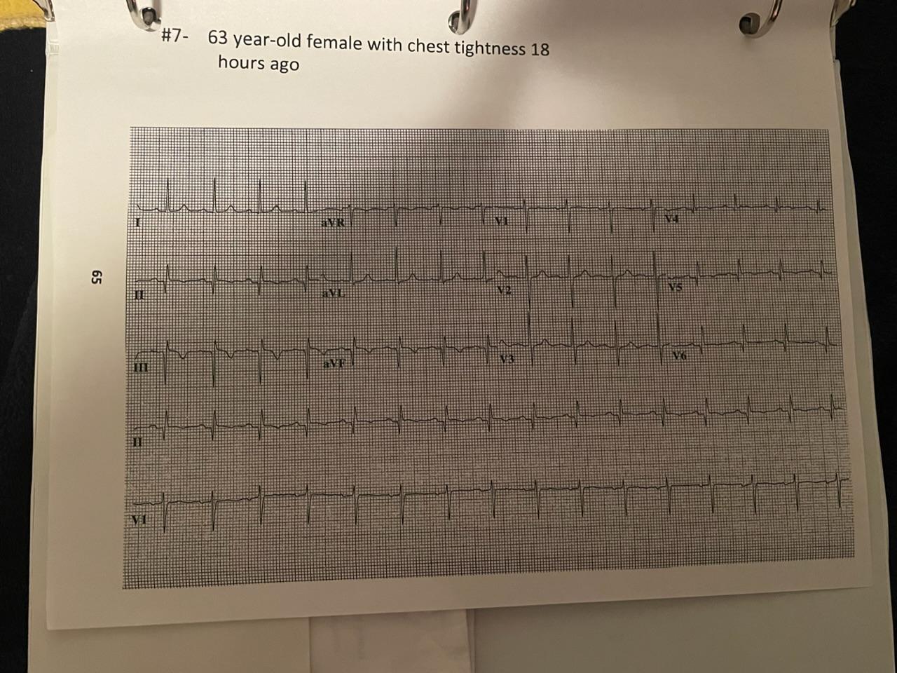 Solved 1. rhythm regular or irregular 2. determine the heart | Chegg.com