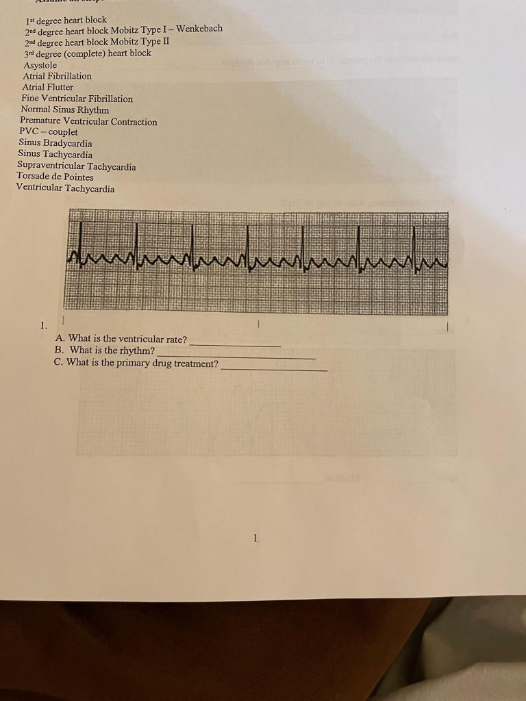 Solved 1* degree heart block 2nd degree heart block Mobitz | Chegg.com