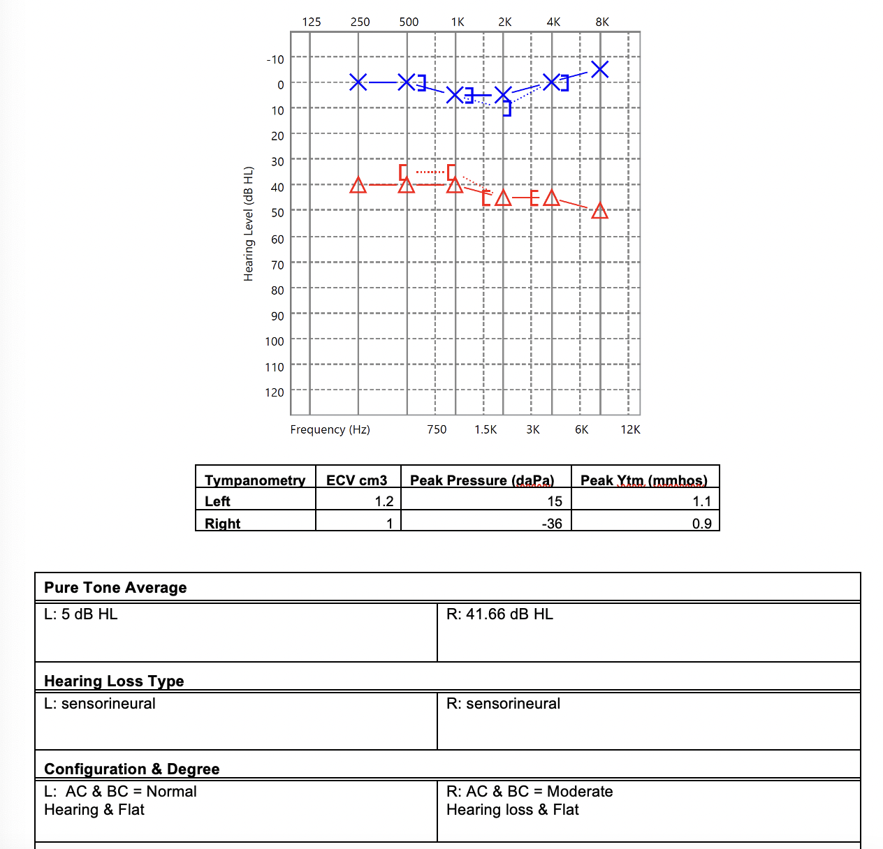 Tympanometry ECV cm3 ﻿Peak Pressure (daPa) ﻿Peak Ytm | Chegg.com