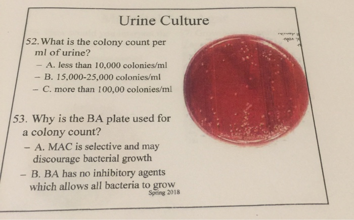 Solved Urine Culture 52. What is the colony count per ml of | Chegg.com