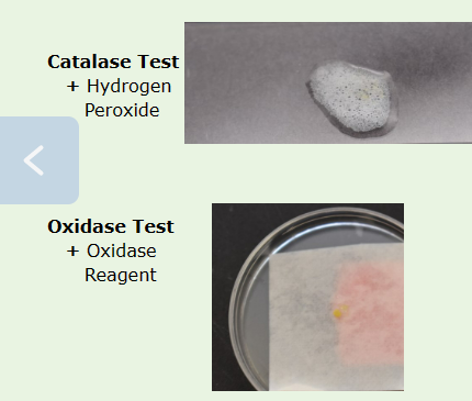 Solved Catalase Test + Hydrogen Peroxide Oxidase Test + | Chegg.com
