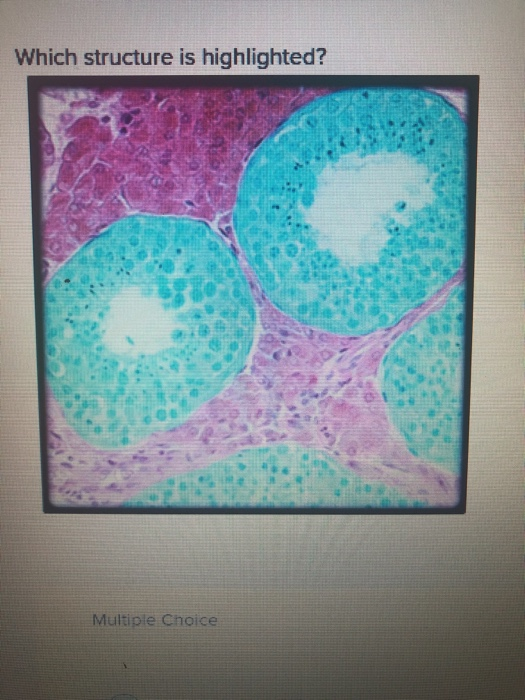 Solved Which structure is highlighted? Multiple Choice | Chegg.com