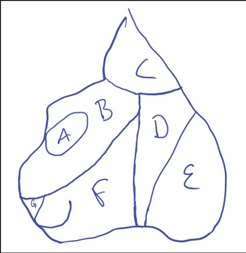 Solved Use the AC-3 algorithm to show that arc consistency | Chegg.com