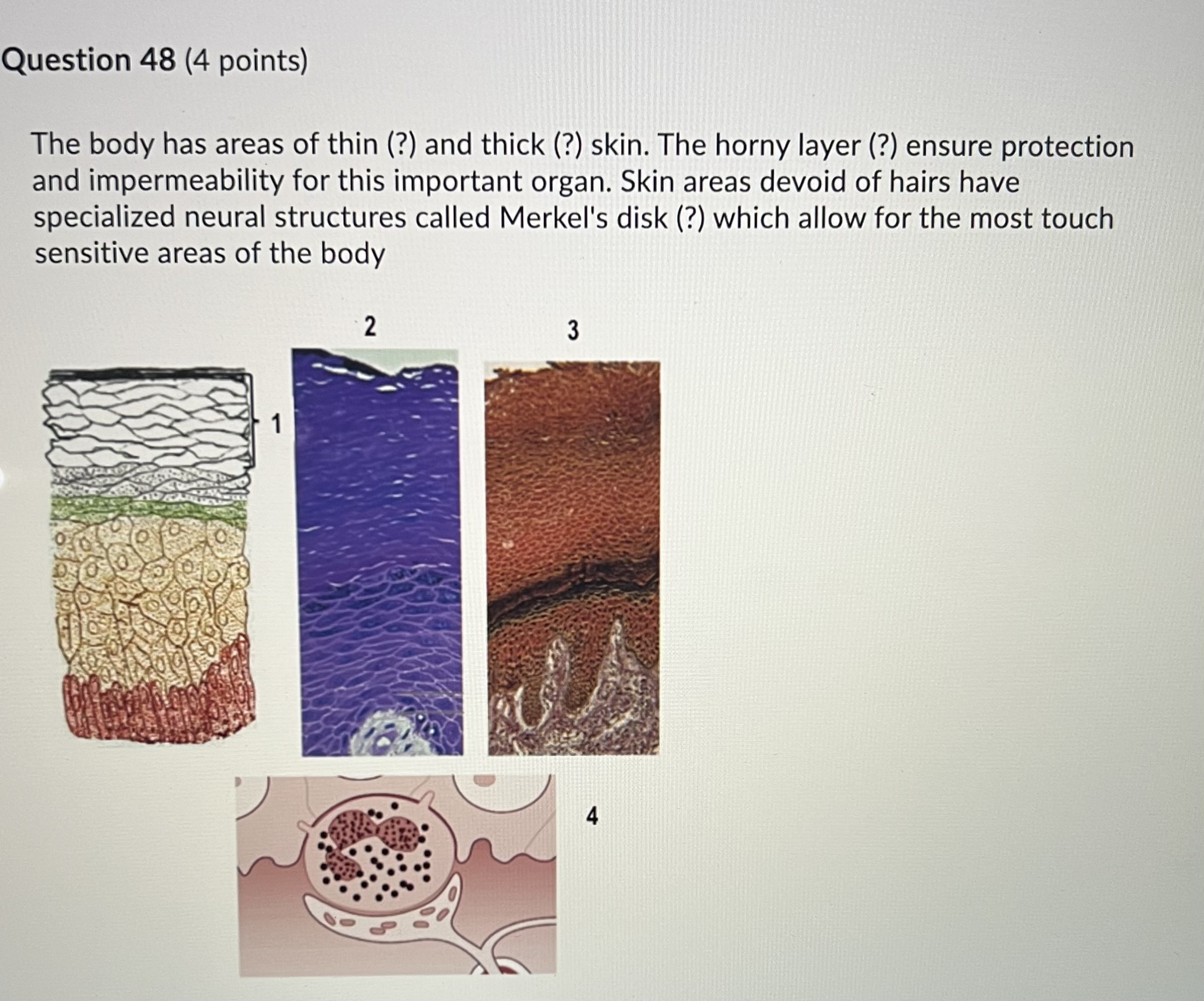 Solved The body has areas of thin (?) and thick (?) skin. | Chegg.com
