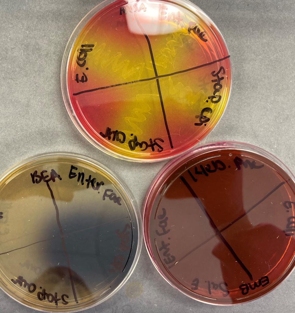 Solved Can anyone help me identify my unknown gram negative | Chegg.com