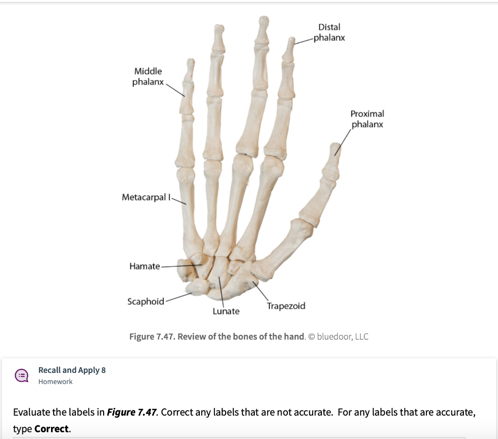 Solved Distal -phalanx Middle phalanx Proximal phalanx | Chegg.com