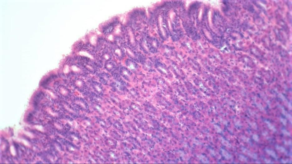 Solved From the Stomach (simple columnar): Recognize slide | Chegg.com