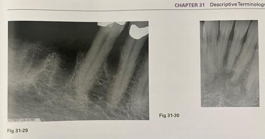 Chapter 31 1. Describe the lesion illustrated in | Chegg.com