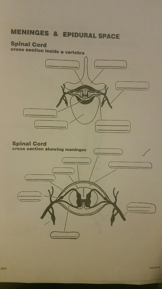 Solved MYELIN SHEATH : myelination A neurolemmocyte (Schwann | Chegg.com