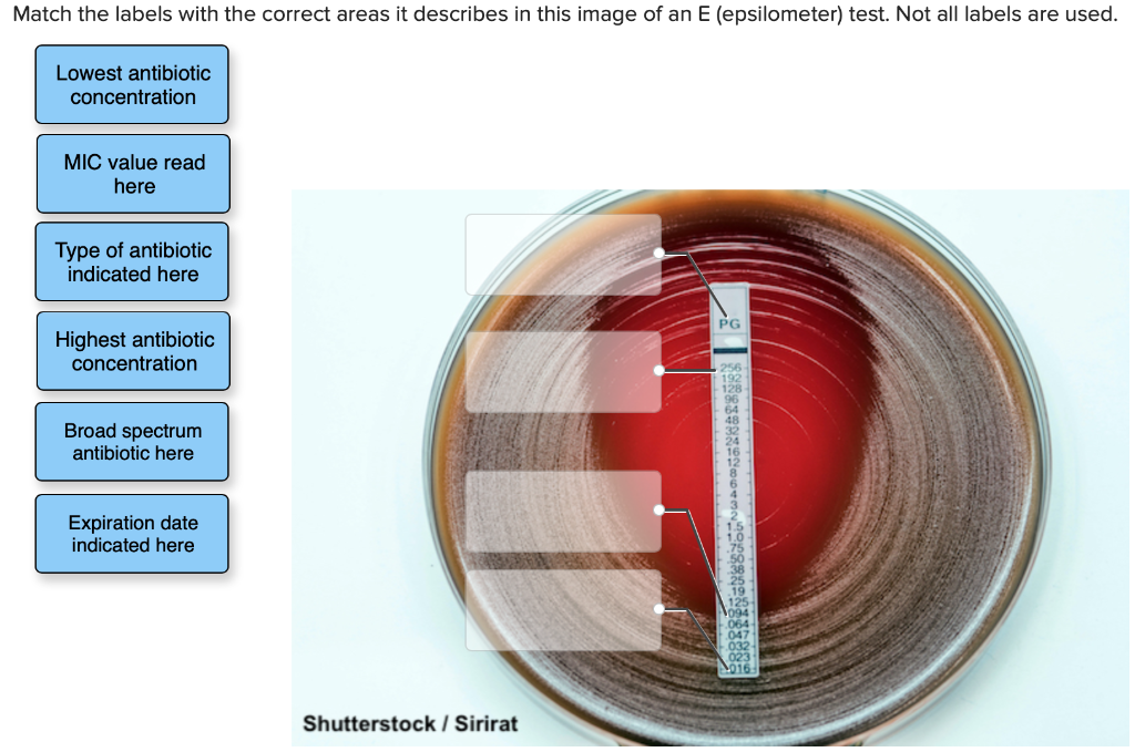 Solved Match the labels with the correct areas it describes | Chegg.com