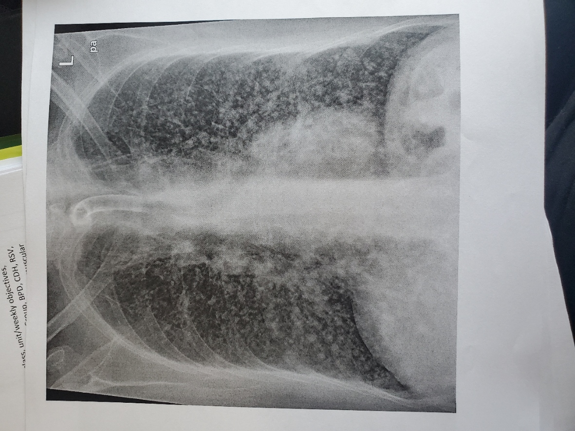 Solved 14- interpret this CXR and explain reasoning behind | Chegg.com