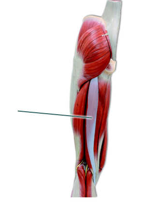 (Get Answer) - Which muscle is highlighted? O semimembranosus O ...