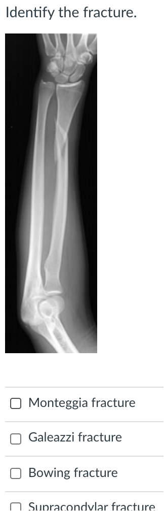 Solved Identify the fracture. Monteggia fracture O Galeazzi | Chegg.com