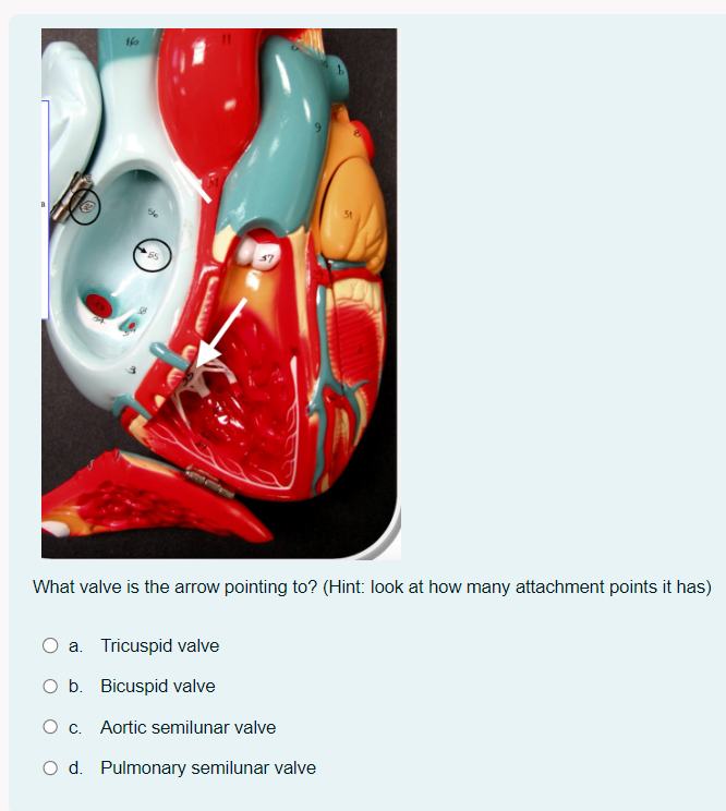 What vessel is the arrow pointing to? a. Superior | Chegg.com