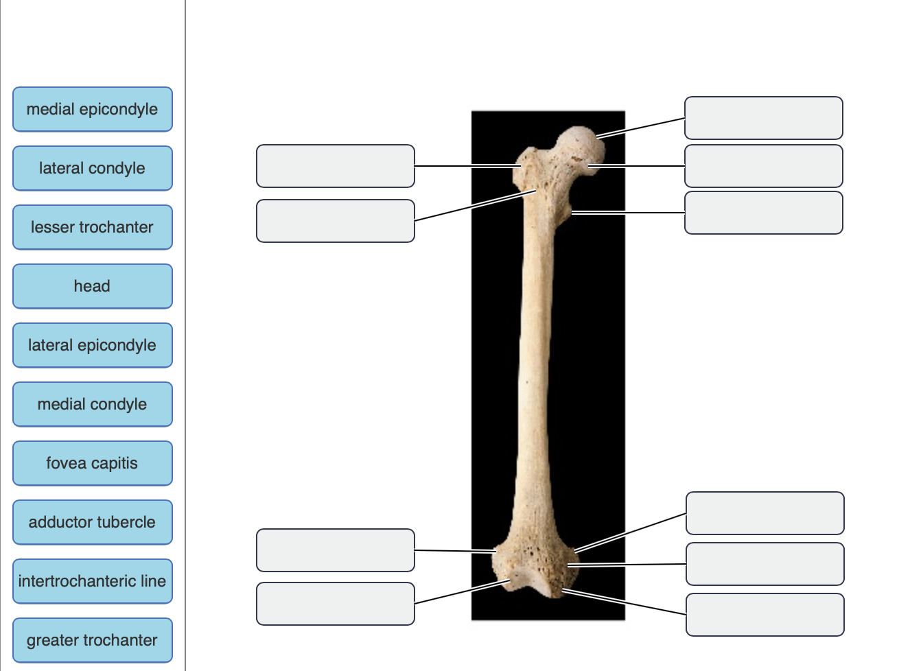 Solved medial epicondyle lateral condyle 11 lesser | Chegg.com