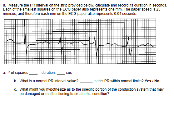 Solved 8. Measure the PR interval on the strip provided | Chegg.com