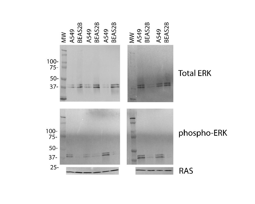 This is a western blot figure. Two cell lysates in | Chegg.com