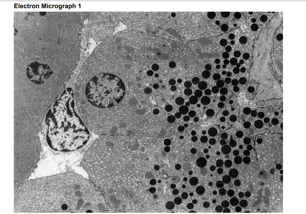 Solved In the electron micrograph, determine the cell type | Chegg.com